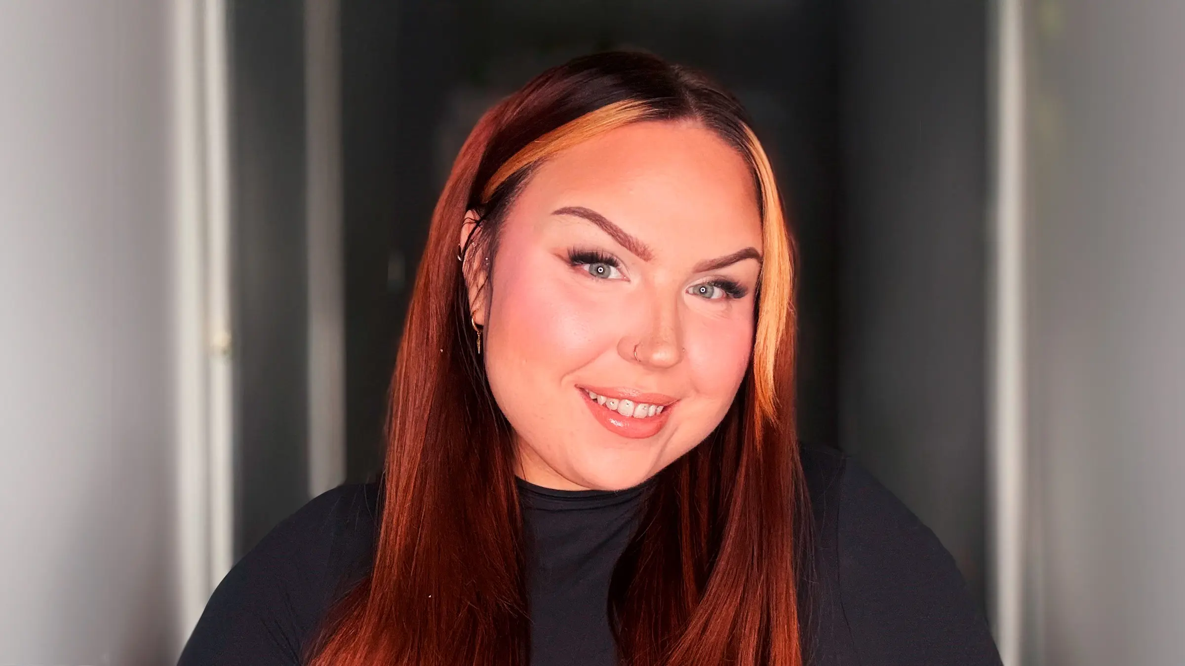 Essi Leppänen sai huonoja kokemuksia täyteainehoidoista | Yhteishyvä